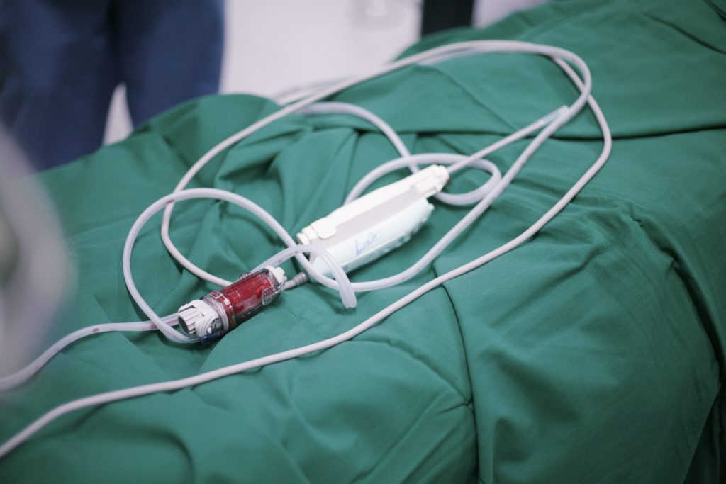 OPERASI TUMOR PAYUDARA TANPA SAYATAN dengan VAB (Vacuum Assisted Biopsy ...